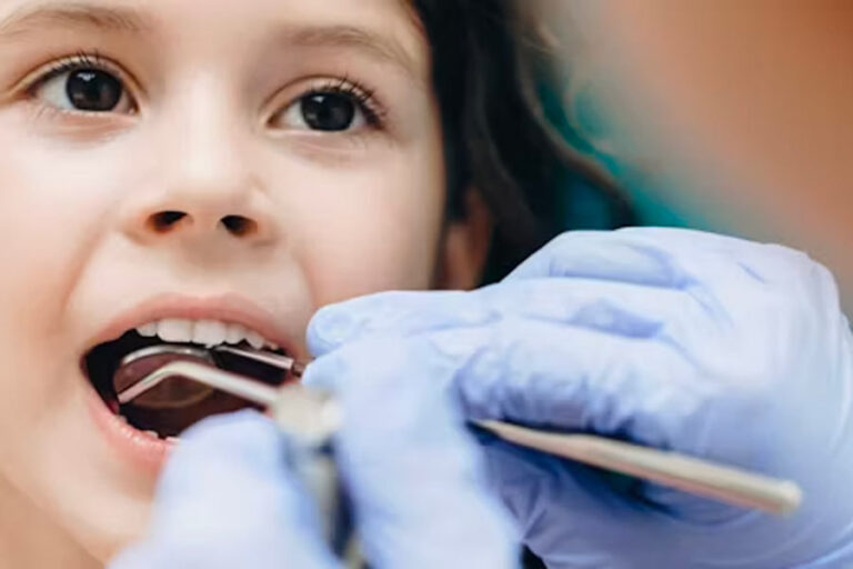 Comment prévenir les caries